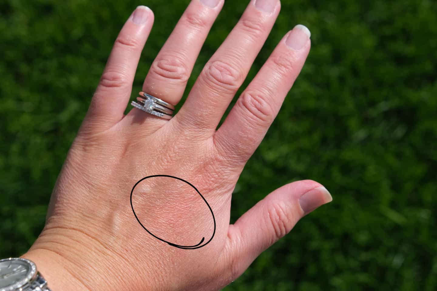 bite away®: a natural insect bite treatment for families with sensitive ...